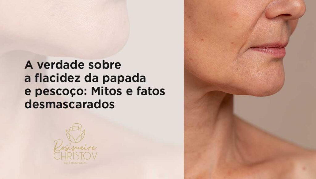 Flacidez da papada e pescoço: Mitos e fatos desmascarados